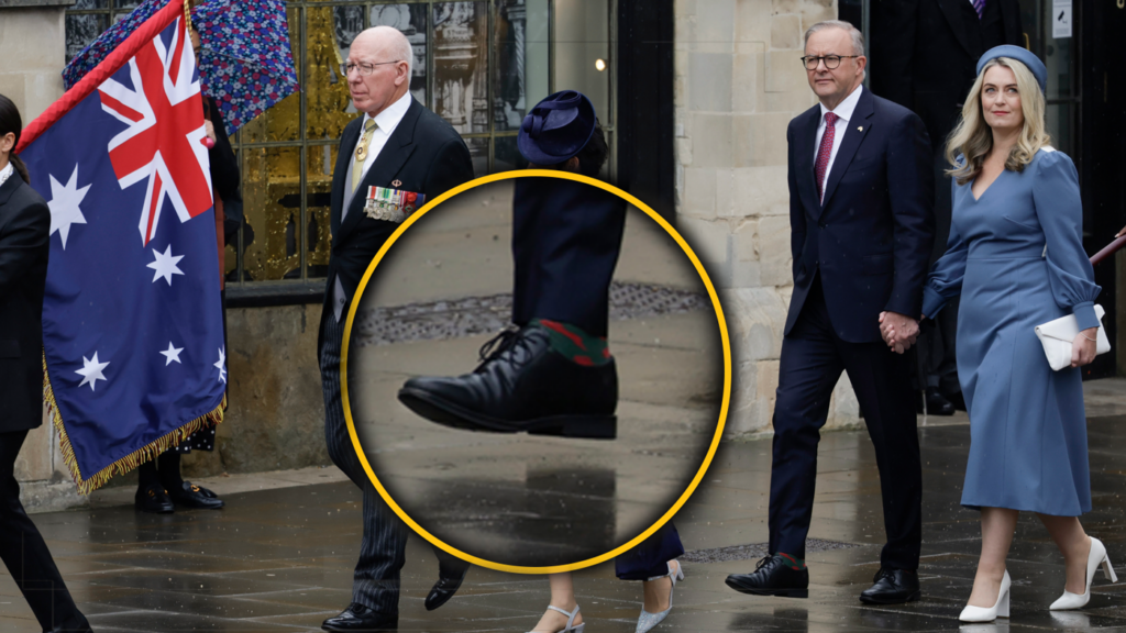 Why PM Anthony Albanese Wore Rabbitohs Gear To King’s Coronation