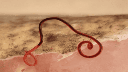 Experts Has Found Dangerous Parasites In New South Wales Waterways