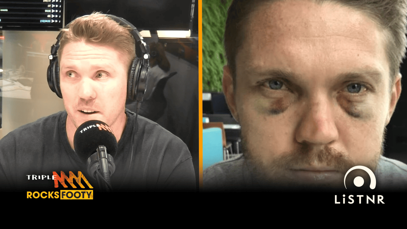 Chris Lawrence On Horrific 2019 Facial Injury "I Just Felt My Face ...