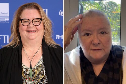 Magda Szubanski reveals stage 4 cancer diagnosis